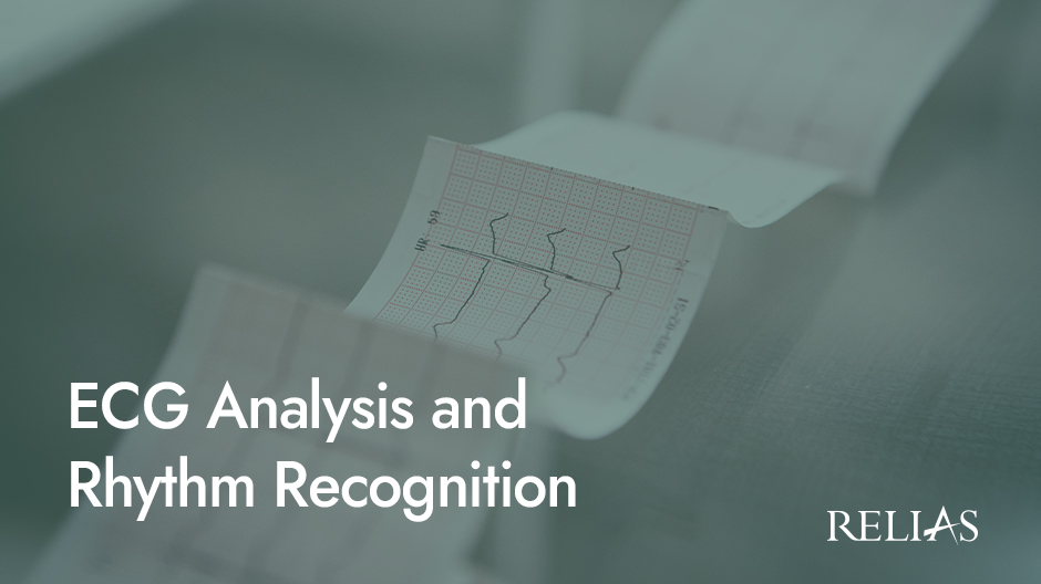 ECG Analysis and Rhythm Recognition | Relias Academy