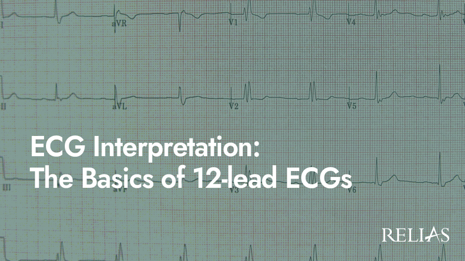 ECG Interpretation: The Basics of 12-Lead ECGs | Relias Academy