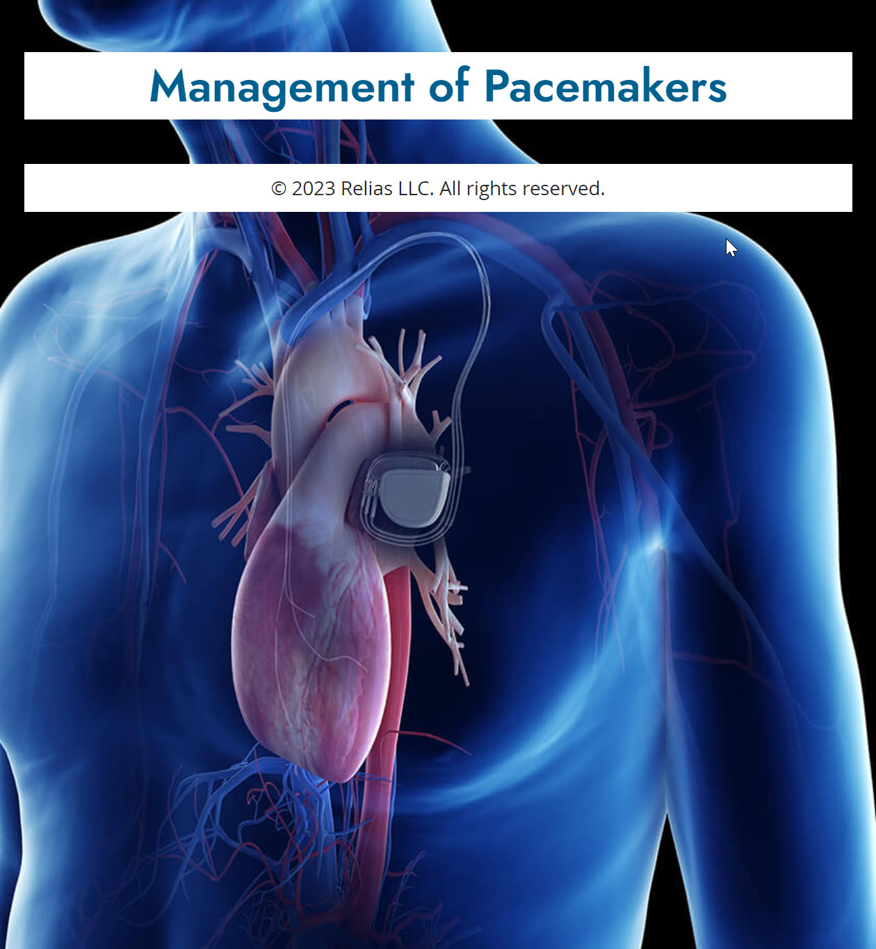 Management of Pacemaker | Relias Academy